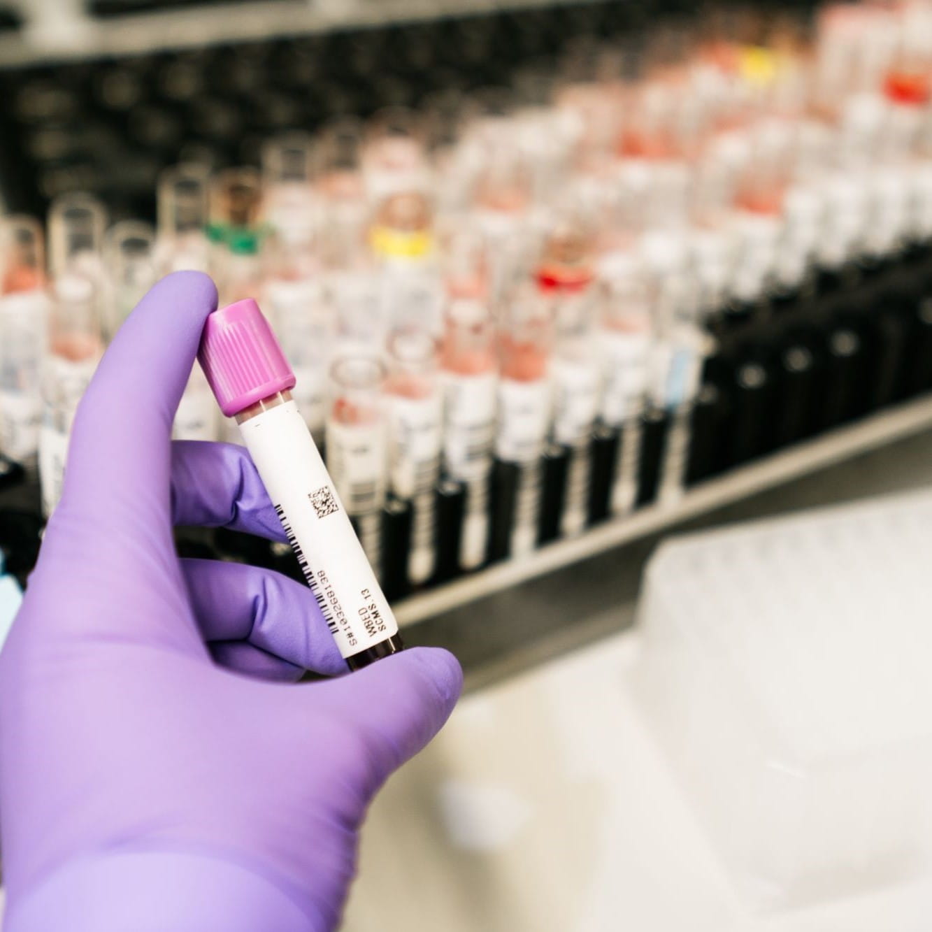 Navigating FDA oversight of LDTs | myadlm.org