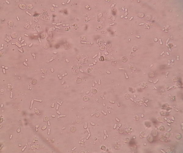 Clinical Chemistry Journal | myadlm.org